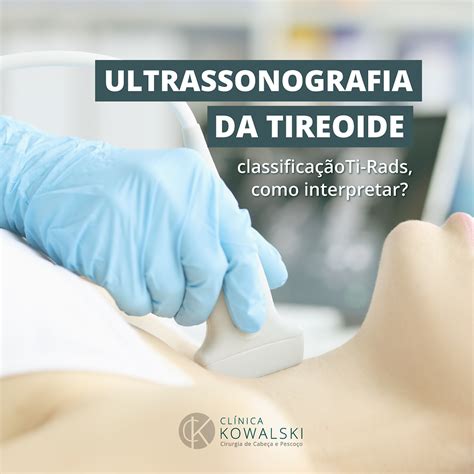 Ultrassonografia Da Tireoide Saiba O Que é A Classificação Ti Rads®