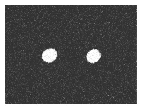 laser speckle segmentation effect of intense light interference under