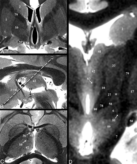 Selected Images Illustrating The Subthalamic Nucleus 6 In The Basal Download Scientific