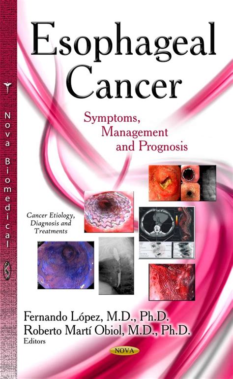Esophageal Cancer Symptoms Management And Prognosis Nova Science Publishers