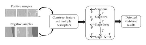 Schematic Of The Cascade Gentle Adaboost Detector Download Scientific Diagram