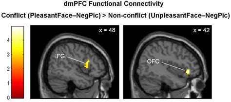 Orbitofrontaler Cortex