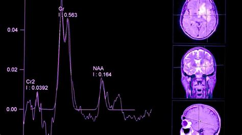 Understanding The Basics Of Ftir Spectroscopy A Comprehensive Guide