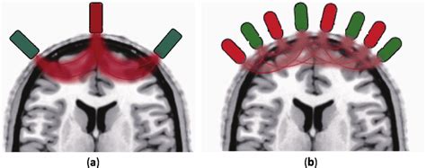 images depict source red detectors green pairs placed on the head