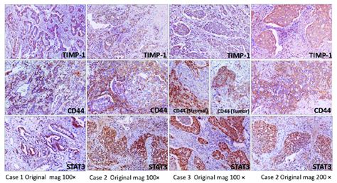 Formalin Fixed Paraffin Embedded Surgical Pathology Specimens From