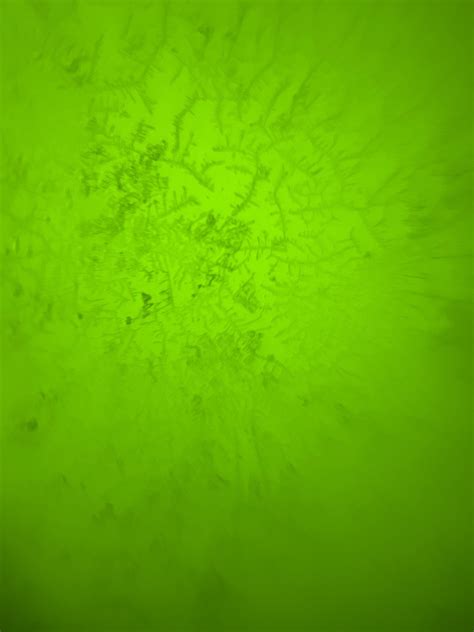 New To Ovulation Microscopes Is This Partial Or Full Ferning