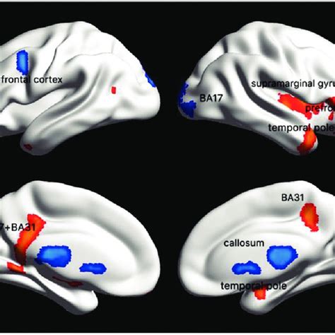 Global Functional Connectivity Density Alterations In Healthy