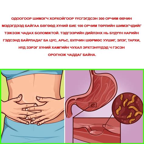 ШИМЭГЧ ХОРХОЙН ЦАЙ Өвчний шинж Онлайн дэлгүүр Mongolia