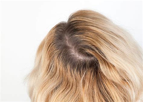 How To Avoid Unwanted Hot Roots