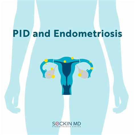 Pid And Endometriosis Seckin Endometriosis Center
