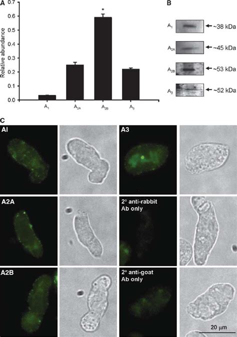 Expression Of Adenosine Receptor Subtypes In Isolated Cerebral Arterial