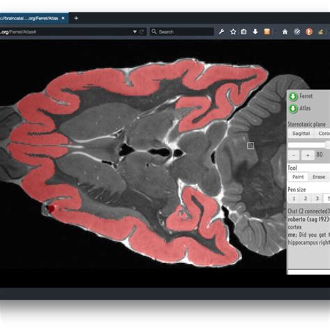 Collaborative Online Brain Segmentation Example From Brain Catalogue Download Scientific
