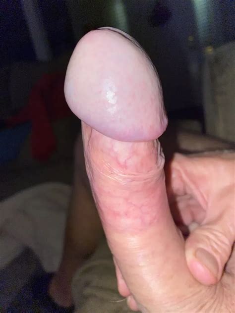 Uncut Penis Pics Xhamster