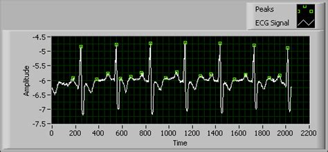 introduction to wavelet signal processing advanced signal processing