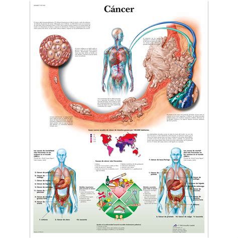 Anatomical Charts And Posters Anatomy Charts Pathology Charts Cancer Chart