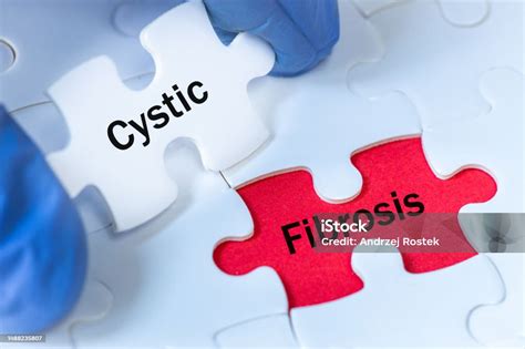 낭포성 섬유증은 폐뿐만 아니라 췌장 간 신장 및 장에도 영향을 미치는 희귀 유전 질환입니다 낭포성 섬유증 질병 감지 및 치료 퍼즐 레터링 Referendum에 대한 스톡