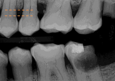 Radiology Quiz 10 23 Flashcards Quizlet