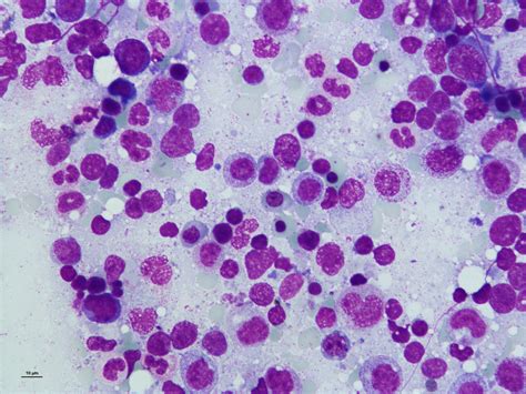 Are We Seeing Downstream Effects Of Ambiguous Labelling On New Generalist Models Usage