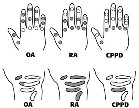 Dm Imaging Flashcards Quizlet