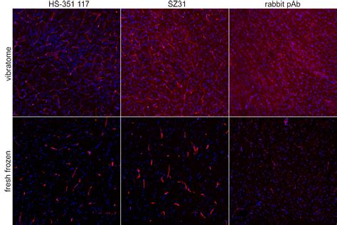 Cd31 As Marker For Endothelial Cells