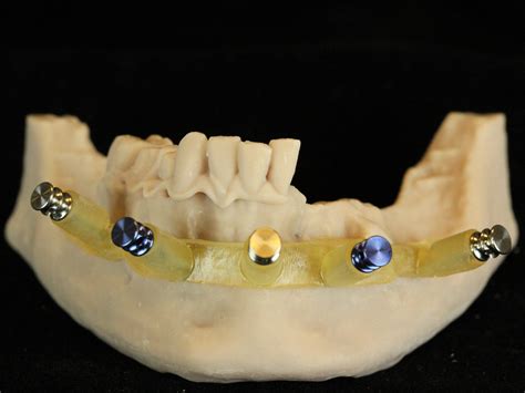 Dual Arch Guided Case Fp1 Over Hybrid Cory Glenn