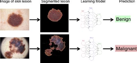 Figure 10 From Classification Of Melanoma Skin Cancer Using Images