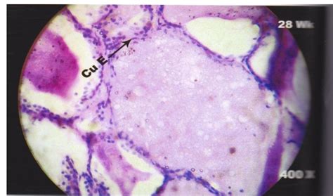 Photo No 4 Microscopic Structure Of Thyroid Gland Of 28