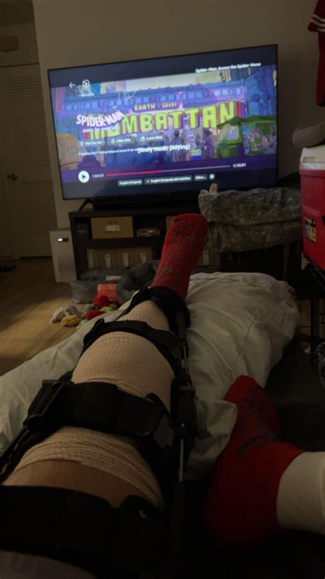 Mcl Sprain Tearsurgeryrecovery Rmclsprain