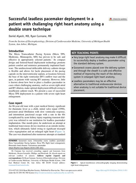 Pdf Successful Leadless Pacemaker Deployment In A Patient With