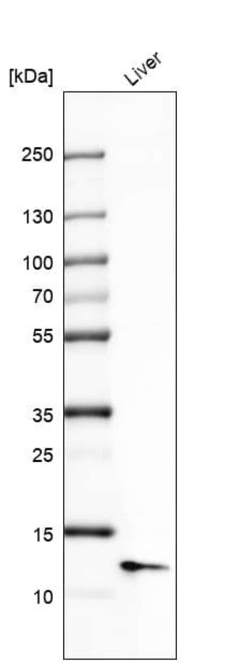 Serum Amyloid A1 Antibody Cl9175 Novus Biologicals™ 100 μg