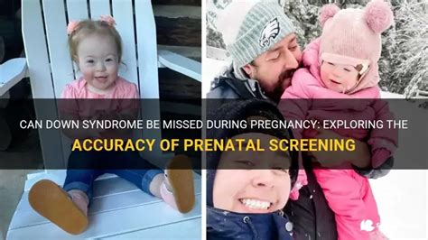 Can Down Syndrome Be Missed During Pregnancy Exploring The Accuracy Of