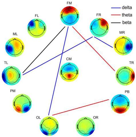 Electrophysiological Signatures Of Atypical Intrinsic Brain