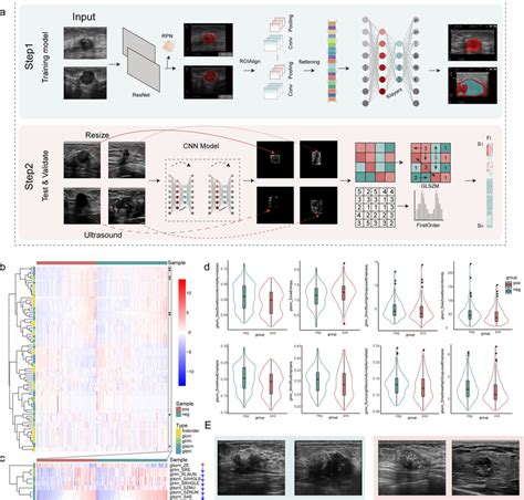 Ultrasound Images Segmentation And HER Status Related URFs Extraction Download Scientific