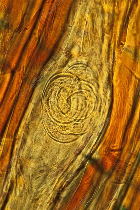 Nematode Larval Cyst Light Micrograph Stock Image C0118129