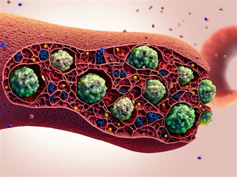 食管癌的分期和分型有哪些? 食管癌治疗 食道癌 肿瘤疾病大全癌症肿瘤科普知识 有来医生 食管癌的分期和分型有哪些? 食管癌治疗 食道癌 肿瘤疾病大全癌症肿瘤科普知识 有来医生