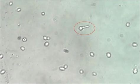 Candida Albicans Morphology Life Cycle Pathogenesis Treatment Biology Notes Online
