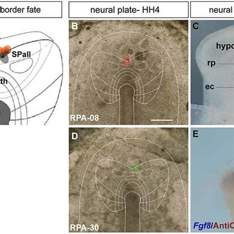 Ectodermal Fate Analysis Of The Experimental Case Rpa 06 A Map Of