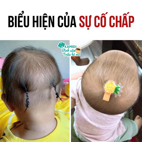 Váy Cưới Con Gái Thì điệu đà Lên Facebook