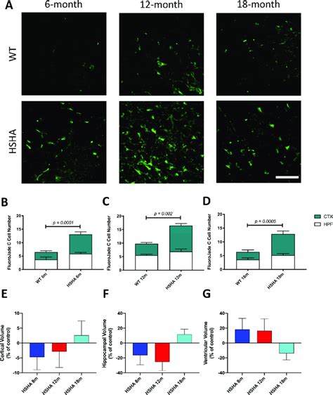 Neuronal Degeneration And Brain Volumetric Analyses In Hsha Mice A