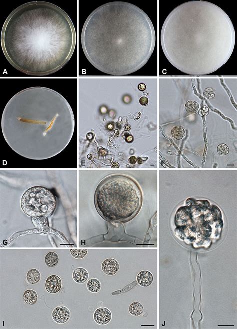 Pythium Aphanidermatum Atlas Of Clinical Fungi