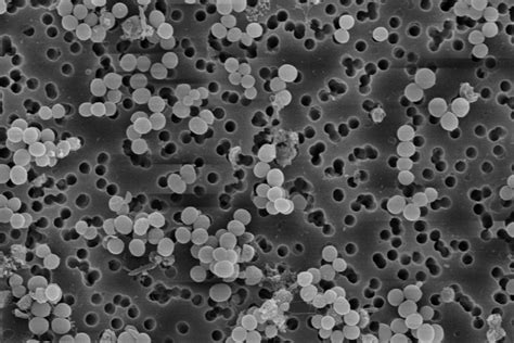 Sem Edx Analysis Laboratory Services Measurlabs