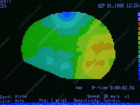 Eeg Brain Scan Results Warwick University 1994 Stock Video Clip K013 4824 Science Photo