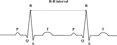 Features Of Standard ECG Signals Composed Of P Q R S And T Waves Download Scientific Diagram