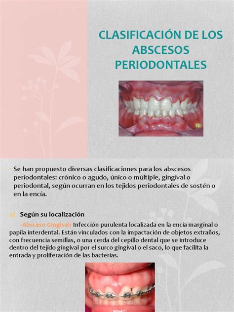 Clasificación De Abscesos Periodontales Pdf Epidemiología