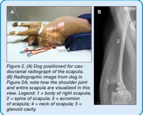 Diagnostic Imaging Final Practical Thoracic Limb Flashcards Quizlet