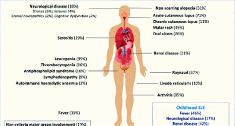 Frequencies Of Organ Involvement In Sle Download Scientific Diagram