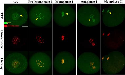 Cellular Localization Of Ttp In Mouse Oocytes Oocytes At Gv Download Scientific Diagram