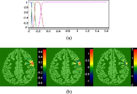 Figure 1 From Statistical Parametric Mapping Of Functional Mri Data