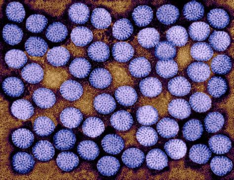 Rotavirus Photograph By Dennis Kunkel Microscopy Science Photo