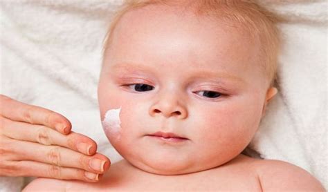 Мазь при атопическом (аллергическом) дерматите: обзор гормональных и ...